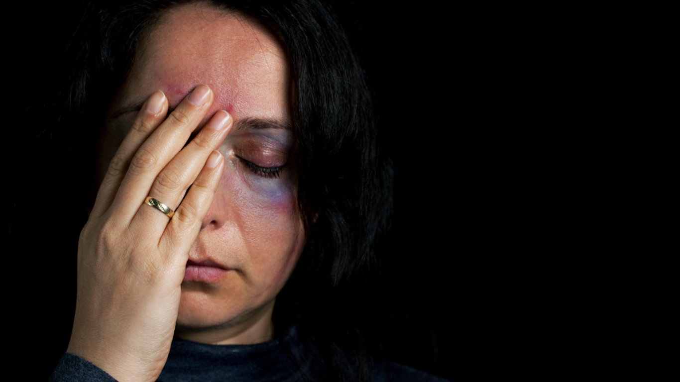 ACID Victims – Sudhir Foundation